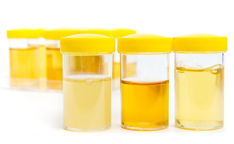 Urynoterapia rzeczywiście działa? Właściwości moczu - Aktualności ...